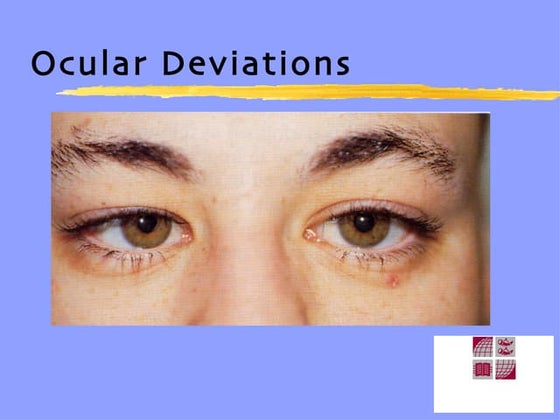 Mallet Unit | PPT | Eye and Vision Conditions | Diseases and Conditions