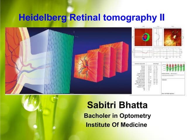 Heidelberg retinal tomography Introduction to interpretation | PPTX