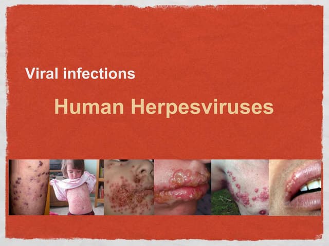 Herpes simplex virus | PPTX