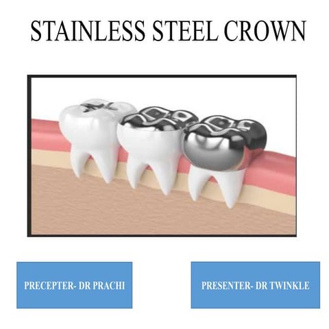 Stainless steel crowns | PPTX