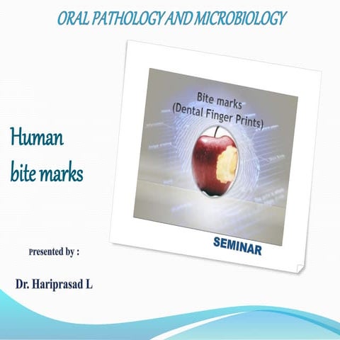 Human bite marks | PPTX