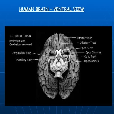Human Brain Ventral View | PPT