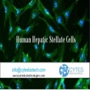 Human hepatic stellate cell isolation and characterization: hepatic ...
