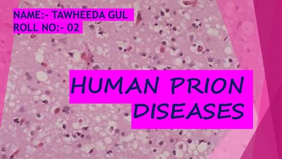 Creutzfeldt Jakob Disease Ppt
