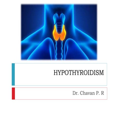 Hypothyroidism Diagnosis, Etiopathogenesis and Treatment | PPTX