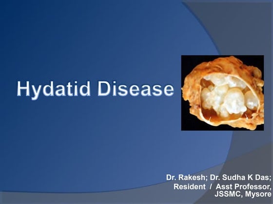 Hydatid cyst | PDF