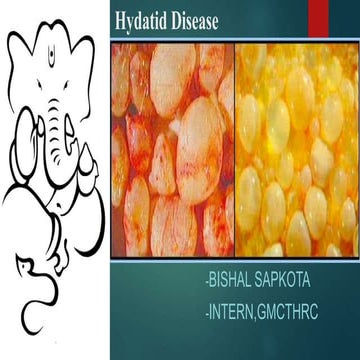 Hydatid disease | PPTX