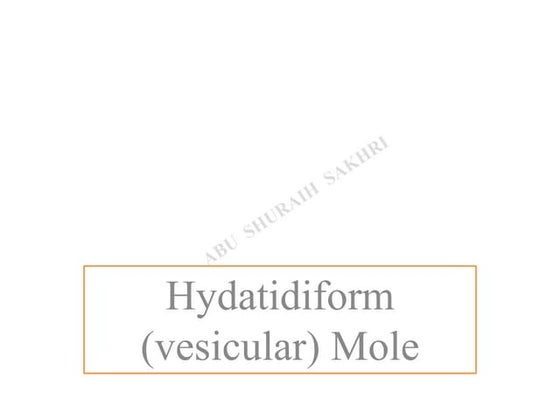 3) HYDATIDIFORM MOLE.pptx