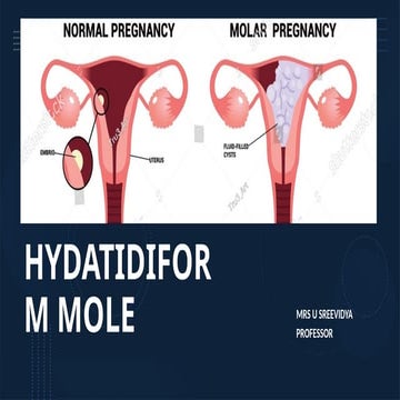 BLEEDING IN EARLY PREGNANCY HYDATIDIFORM MOLE.pptx