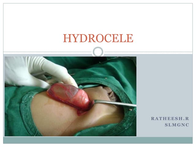 Hydrocele- All types & treatment options | PPTX