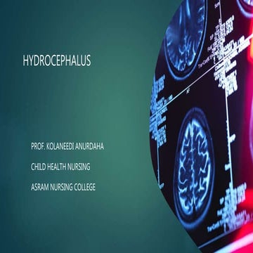 Hydrocephalus | PPT