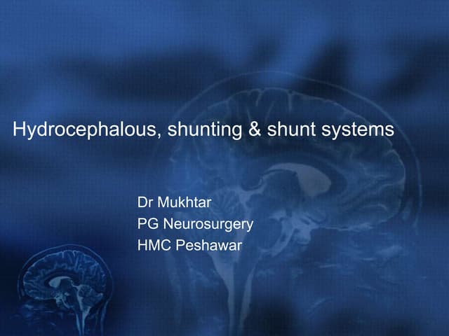 VP shunt OR | PPTX