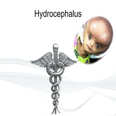 Hydrocephalus | PPTX