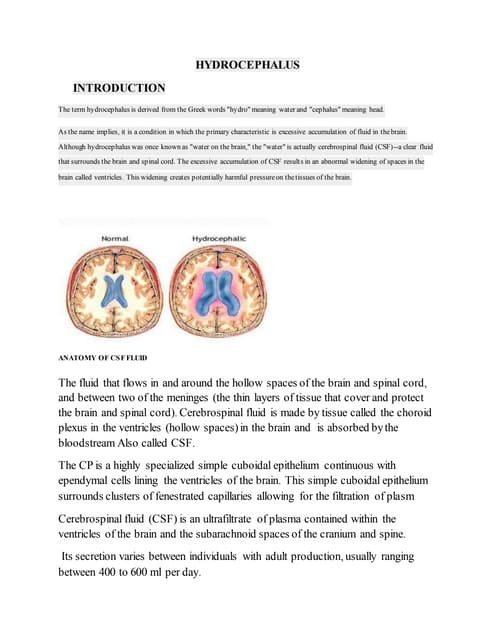 Hydrocephalus | PPTX | Brain and Nervous System Disorders | Diseases ...