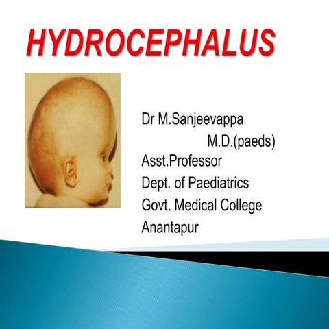 HYDROCEPHALUS | PPTX