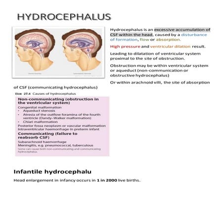 hydrocephalus.docx