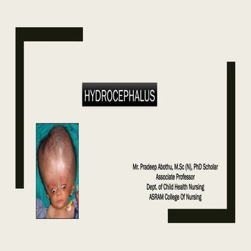 HYDROCEPHALUS: NURSING MANAGEMENT .pptx