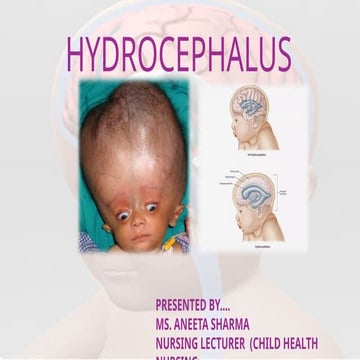 Hydrocephalus pptx | PPTX