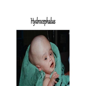 HYDROCEPHALUS.pptx