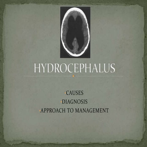 Hydrocephalus - Dr Sameep Koshti (Consultant Neurosurgeon) | PPTX