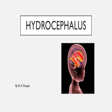 HYDROCEPHALUS final (1) in children. Causes and management | PPTX