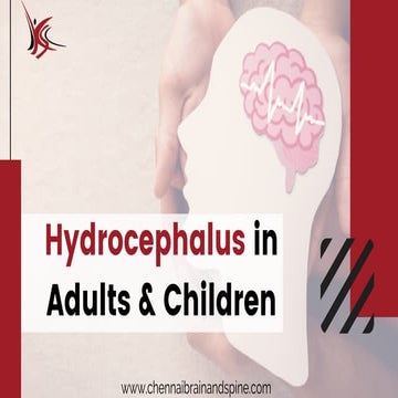 Hydrocephalus in adults and children | PDF