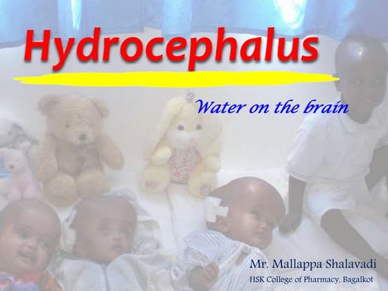 Hydrocephalus : Its Avaliable Treatments | PPT