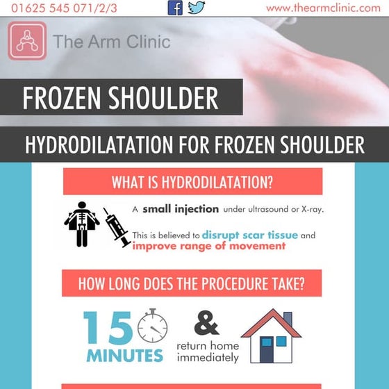 Hydrodilatation for frozen shoulder | PPT | Injuries | Diseases and ...
