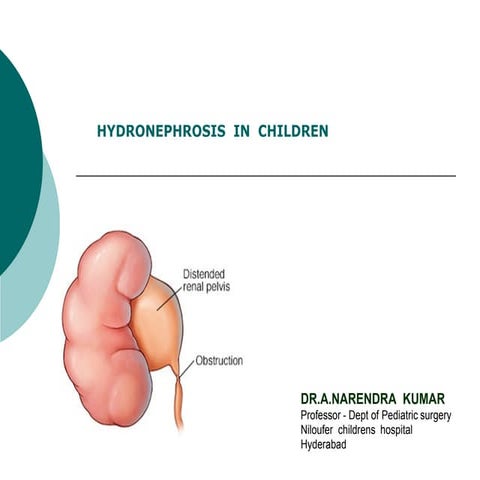 HYDRONEPHROSIS.pdf antenatal paediatric | PDF