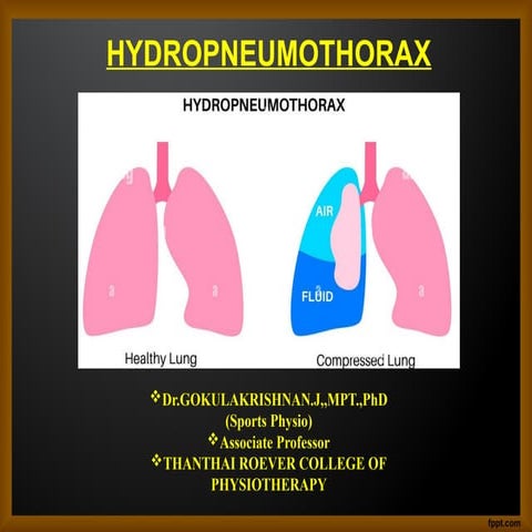 Comprehensive Overview of Breast Carcinoma: Types, Risks, Diagnosis ...