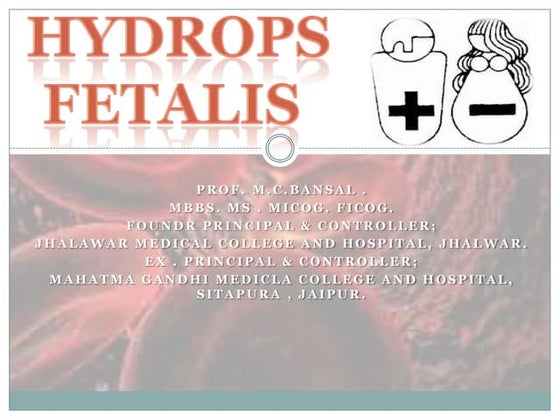 Hydrops | PPT