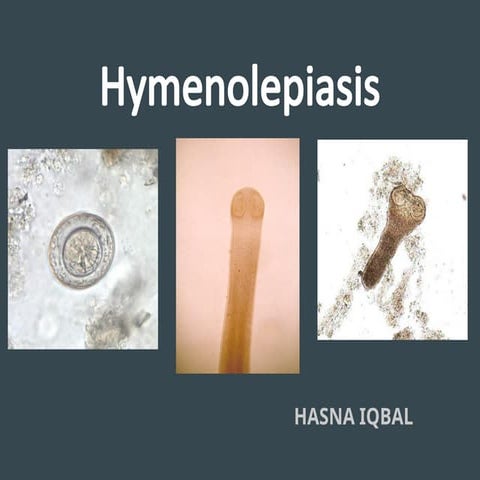 Hymenolepiasis Presentation full overview | PPTX