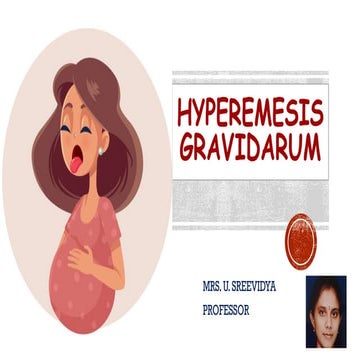 Occipito posterior position | PPTX