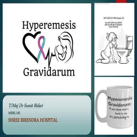 HYPEREMESIS GRAVIDARUM | PPTX