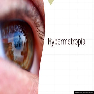 Hypermetropia - Intro, Causes, Types , Symptoms and Management | PPTX