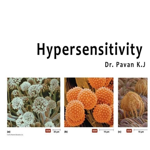 Hypersensitity, And Types of Hypersensitivity I, II, III, IV | PPT