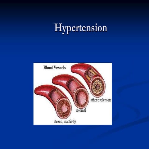 Hypertension.ppt | Heart and Cardiovascular Diseases | Diseases and ...