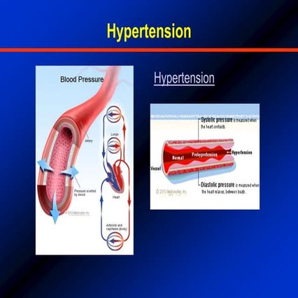 Hypertension pathophysiology | PPT