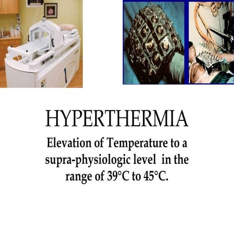 Hyperthermia 07-4-2016 | PPTX