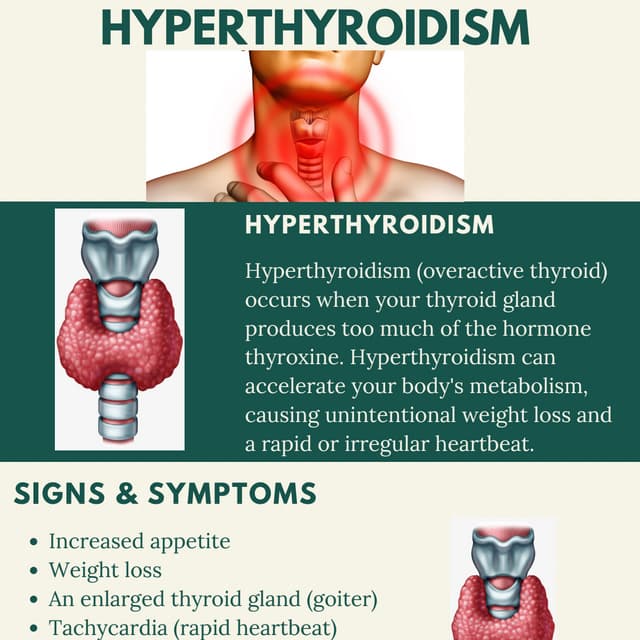 CASE PRESENTATION ON HYPERTHYROIDISM | PPTX
