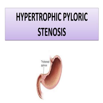Hypertrophic Pyloric Stenosis | PPT