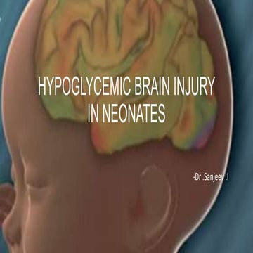 neonatal hypoglycemia- approach, diagnosis and management | PPT