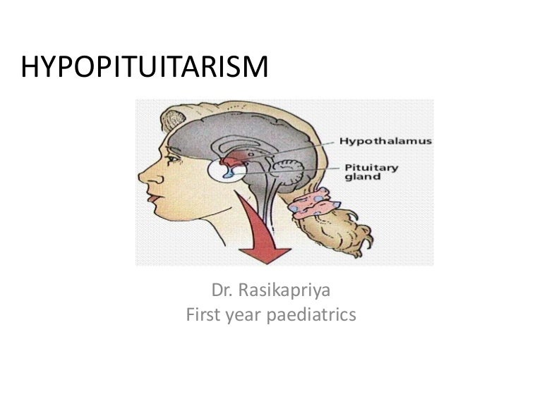 Hypopituitarism hypopituitarism
