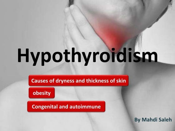 Hypothyroidism | PPTX | Thyroid Disorders | Endocrine and Metabolic ...