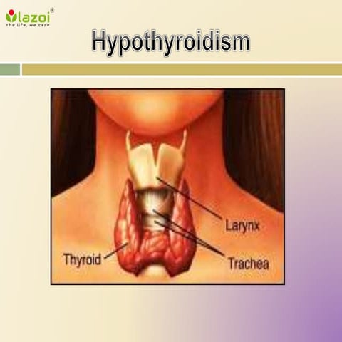 Hypothyroidism | PPT