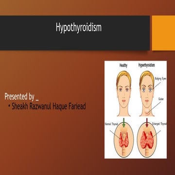 Hypothyroidism | PPTX