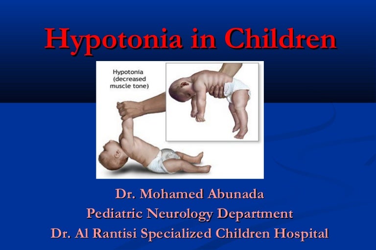 Hypotonia in children
