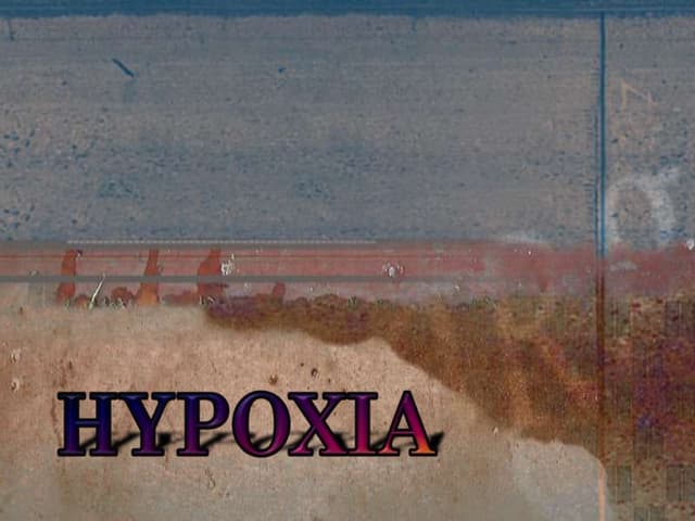 Abnormal types of respiration, HYPOXIA, ASPHYXIA, Cyanosis (The guyton ...