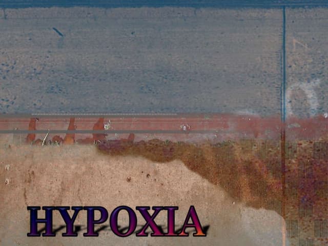 Abnormal types of respiration, HYPOXIA, ASPHYXIA, Cyanosis (The guyton and hall physiology) | PPTX