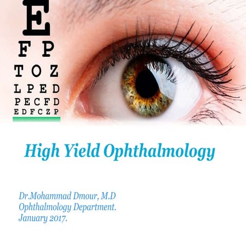 Ophthalmology High yield review | PPT